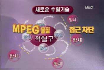 NPEG 투입해 혈액형과 관계없이 수혈 가능[신원식]
